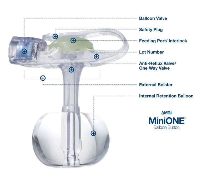 Low Profile Gastrostomy Balloon Button - TECHNOPATH